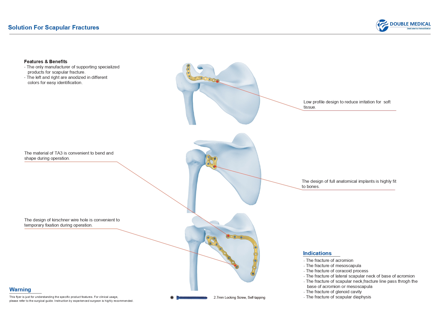 Scapular Locking Plate System,Medical Device Manufacturers -Double Medical