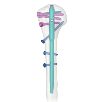 OLIF Oblique Lateral Interbody Fusion Cage,Medical Device Manufacturers ...