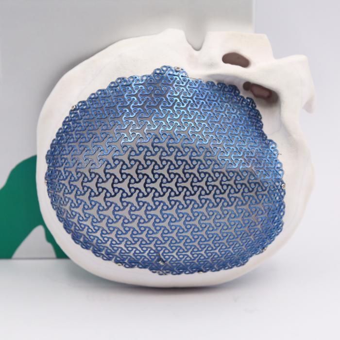 CMF,Cranial System,Patient Specific Solution